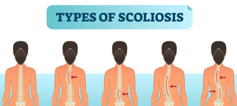 understanding-scoliosis-causes-symptoms-treatment - Site title